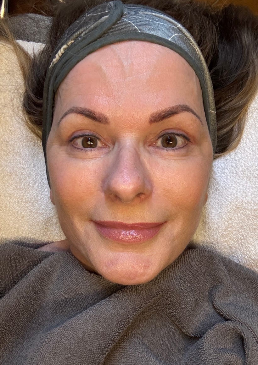 Laxsperma … let’s talk about it! | Monas Universum | Amelia